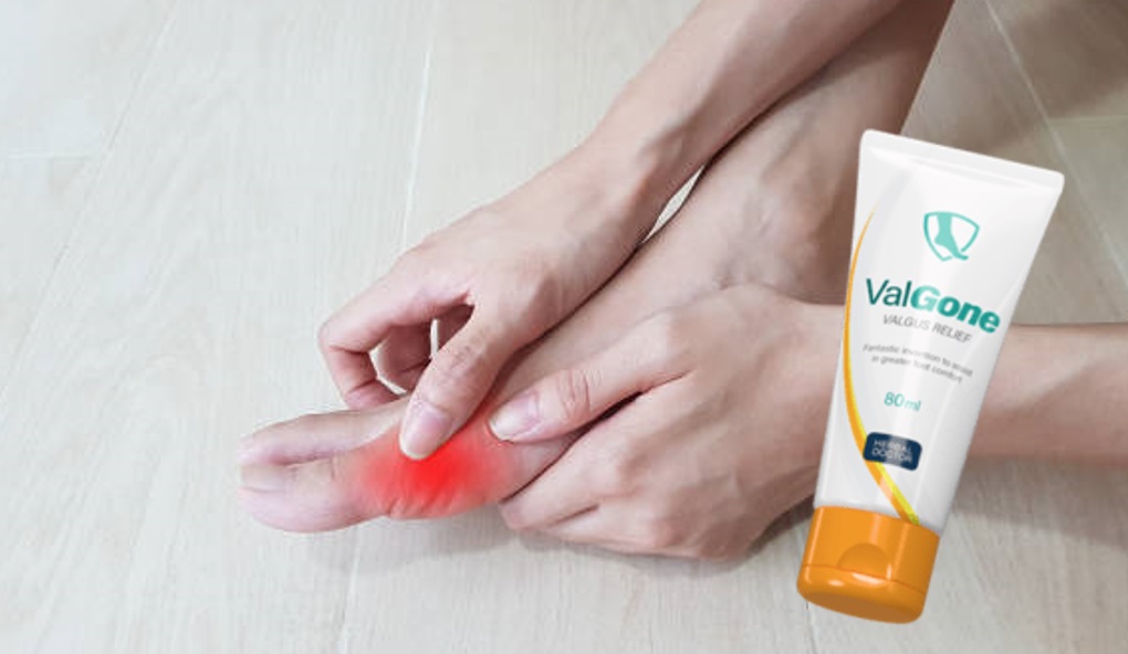 ValGone crema - opiniones, foro, precio, ingredientes, donde comprar ...